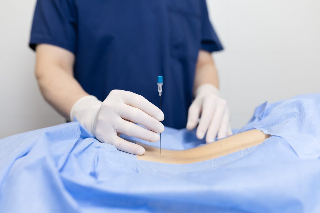 X-ray and ultrasound-guided blocks and targeted injections - Spravno